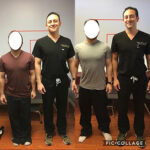 Height Lengthening Surgery Before & After Gallery - Height Lengthening