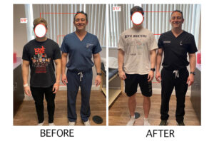 Before & After Gallery - Height Lengthening